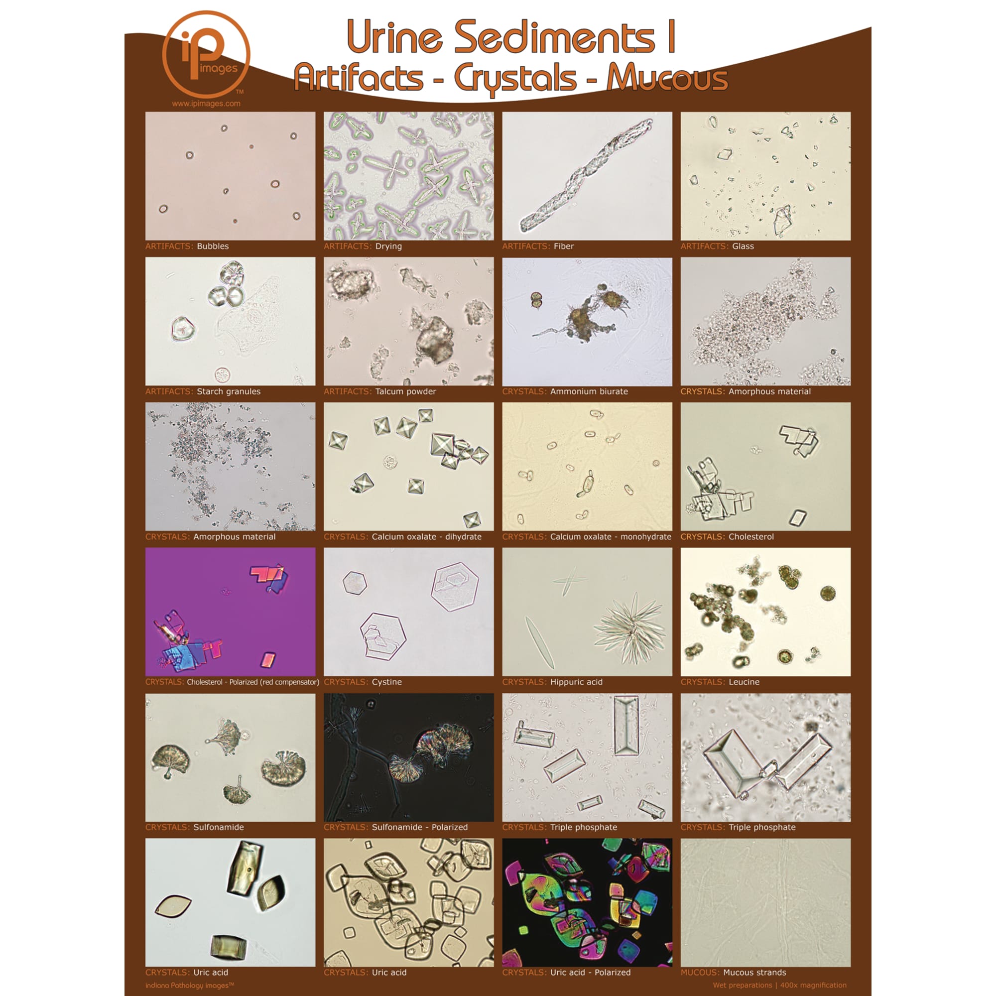 Urine Sediment Identification