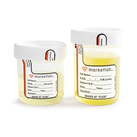 Marketlab Wide-Mouth Urine Specimen Cups | Marketlab