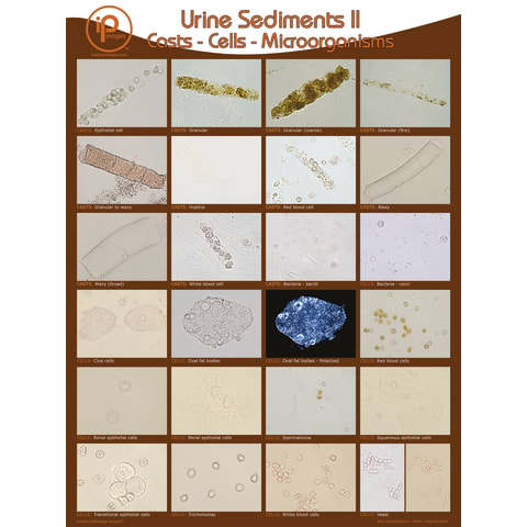 Urine Sediments, Poster II • 18"W x 24"H | Marketlab