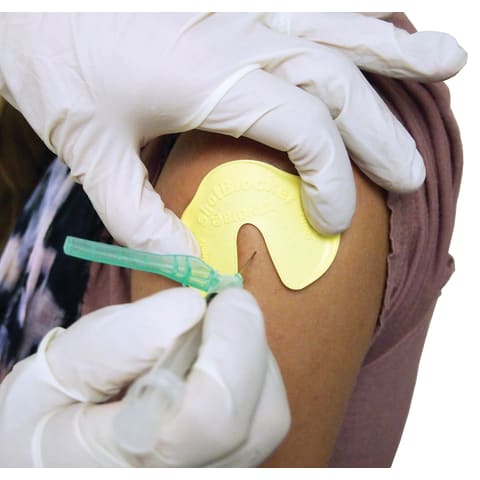 Shot-Blocker-Needle-Anxiety | Hopkins Medical Products