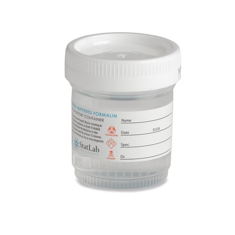 Neutral Buffered Formalin | Marketlab