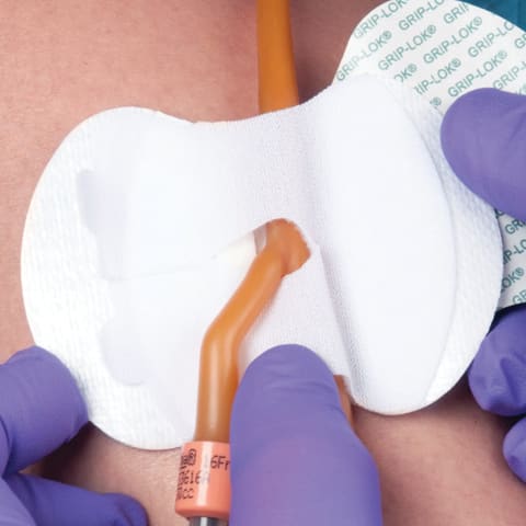 Grip-Lok Universal Securement Device | Marketlab