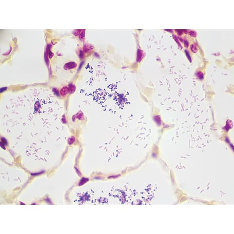 Gram Stain Control Slides | Marketlab