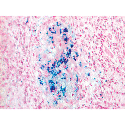 Iron Stain Set, 100mL Set | Marketlab