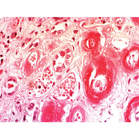 Congo Red Amyloid Stain Kit, 100mL Kit | Marketlab