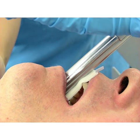 DentaSafe Intubating Dental Guard Marketlab