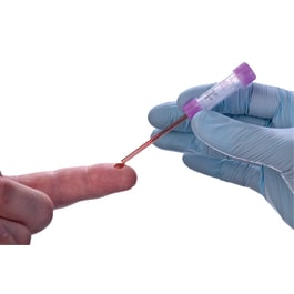 Microvette 100-200 Capillary Collection Device - Marketlab