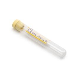 BD Vacutainer® Urinalysis Tubes | Marketlab