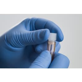 Ribbed Tube Caps For 12mm Tubes - Marketlab