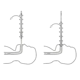 Instrumentation Introducer ETT Changer | Marketlab