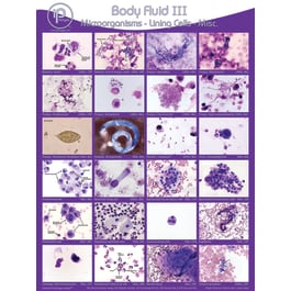 Body Fluid Pathology Reference Poster - Marketlab