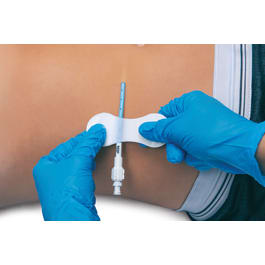 Grip-Lok Universal Securement Device | Marketlab