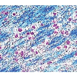 Luxol Fast Blue-CE Violet Kit | Marketlab